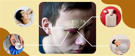 Black Eye Treatment Fast Recovery Tips Shinagawa Lasik