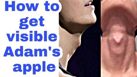 Small Lump On Throat Above Adam S Apple At Sophia Iliffe Blog