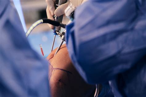 Endoscopic Surgery Resolves Spinal Condition In Achondroplasia
