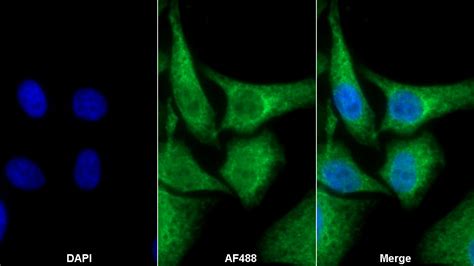 Polyclonal Antibody To Mucin 2 Muc2 Paa705hu01 Homo Sapiens