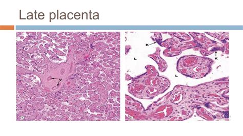 Histology Of The Placentapptx