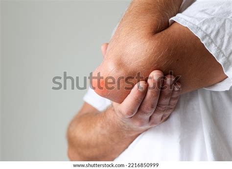 Broken Bursa Sack Elbow