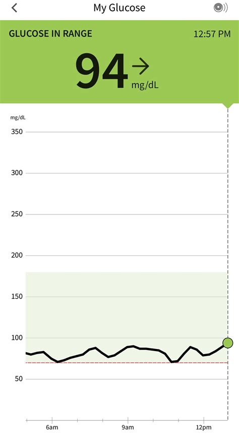 Where Did The Beetus Go R Diabetes T1