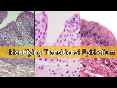 Transitional Epithelial Tissue Jaypeedigital Ebook Reader