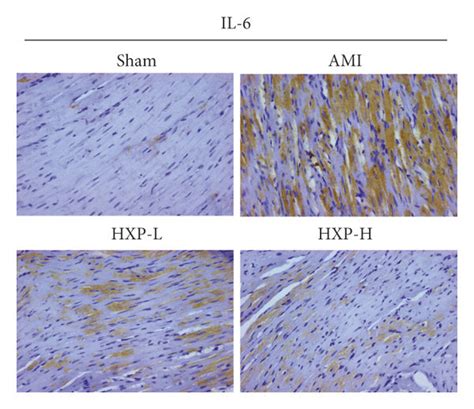 Ihc Analysis Was Performed To Determine The Protein Expression Of