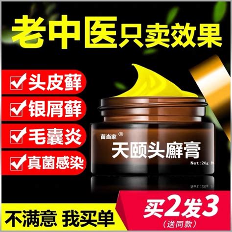 头皮癣专用药膏头皮屑癣治疗头部牛皮藓癣真菌感染银屑病外用药膏虎窝淘