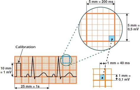 Heart Rate On Ecg Ecg Book
