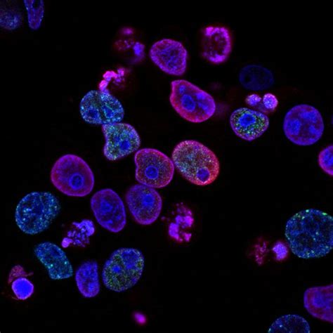 Unexpected Discovery About Stem Cell Immortality Cordbank New Zealand