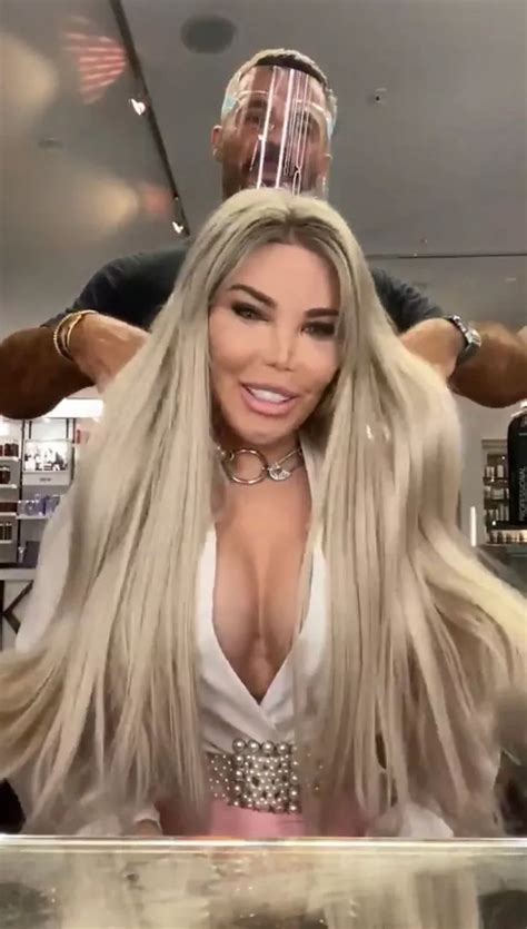 Jessica Alves Shows Off New Hair And Extreme Face Surgery After Coming