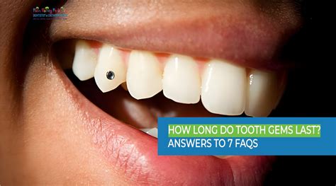 Messed Up Teeth Causes Treatment And Much More Messed Up Teeth Causes Treatment And Much More