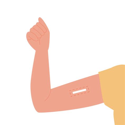 Birth Control Implant