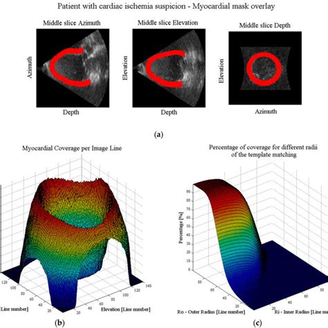Graphical Representation Of A Conical Scan For Anatomical Imaging In 3d