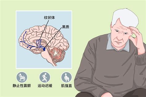 China Customized Intermediates Of Opicapone Suppliers Factory