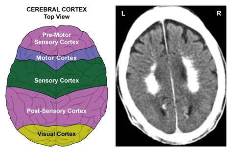 Post Sensory Cortex Constellation