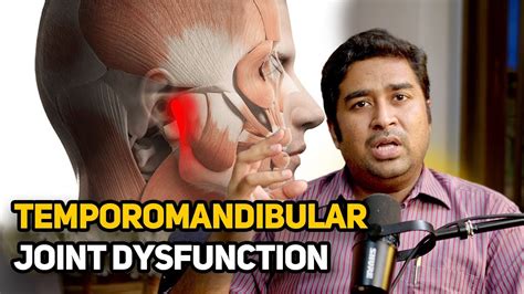 Temporomandibular Joint Dysfunction Dr Vignesh Gokul Youtube