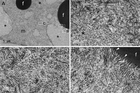 Transmission Electron Micrographs Of Model Processed Cheese After 315