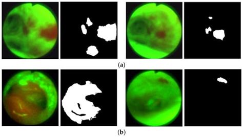 J Imaging Special Issue Advancements In Imaging Techniques For Detection Of Cancer