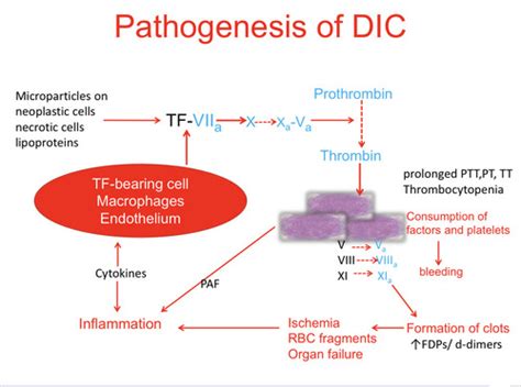 Clinical Pathology Hemostatic Disorders Flashcards Quizlet