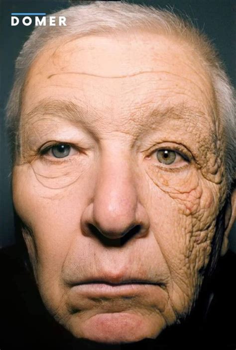 The Damaging Effects Of Uv Rays On Skin