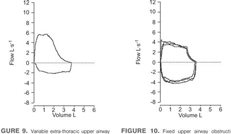 Figure 9 From Standardisation Of Spirometry Semantic Scholar