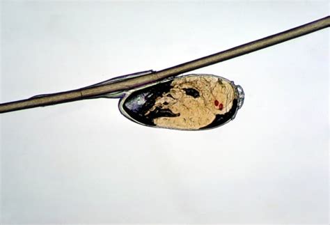 Gambar Gratis Nimfa Kepala Kutu Pediculus Humanus Capitis Parasit Athat Muncul Telur