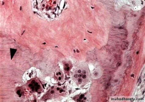 Dentin Pptx Drduran Muhadharaty