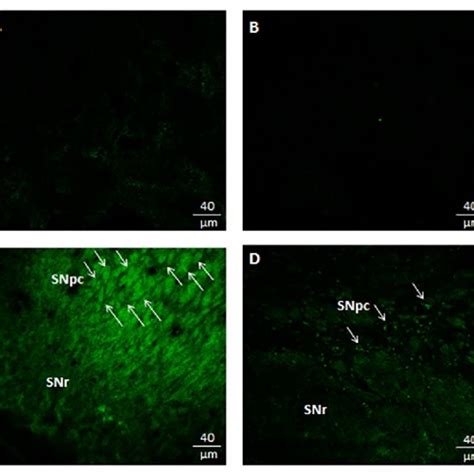 Comparison Of Fluoro Jade C Fjc Staining In The Snpc Between A
