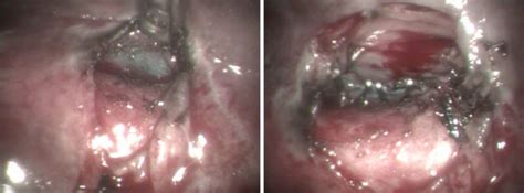 Idiopathic Chylothorax In The Dog • Mspca Angell