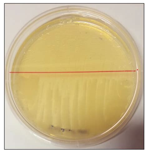 Mejorando La Efectividad De Q Bacter Y Fungi Q Mediante La Selecciónde