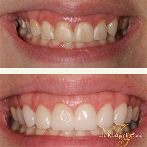 Dr Kristen Forlano Kristenforlanodds • Instagram Photos And Videos