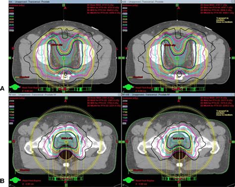 Isodose Curves For The Applied Anisotropic Analytical Algorithm And Download Scientific Diagram