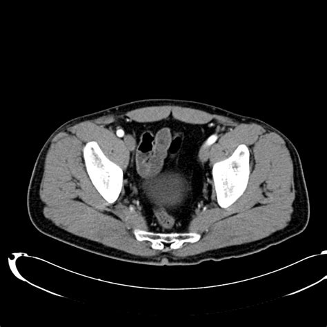 A Systematic Approach To The Interpretation Of Ct Abdomen Pelvis