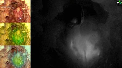 Example Of Parallel Display Mode The Near Infrared Fluorescence