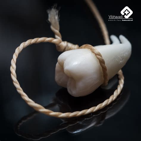 What Is An Impacted Tooth Vibhavadi