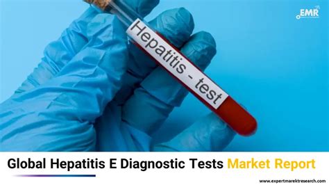 Hepatitis E Diagnostic Tests Market Size And Analysis 2034