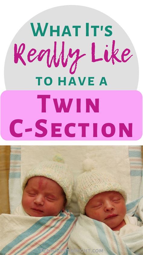C Section Delivery With Twins