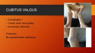 Elbow Disorders 5th Stage Lecture Drfarouk Pptx