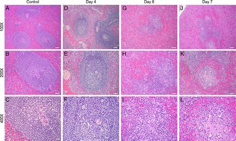 Hande Spleen Mid Disease And Terminal Histopathologic Findings For The Download Scientific