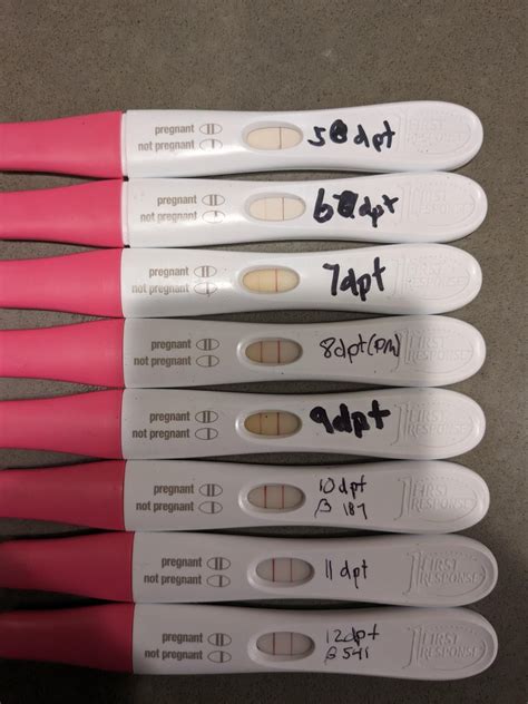 Wondfo Frer Brand Progressions 4 12dp5dt R Tfablineporn