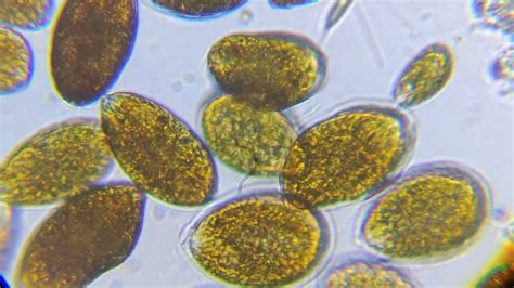 Dinoflagellates Under Microscope