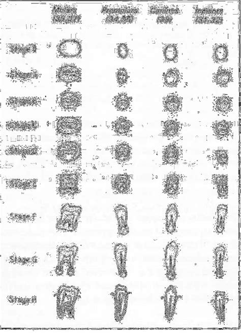 Graphical Presentations Of Stages Of Tooth Development As Given By