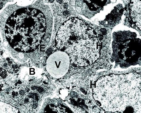 Transmission Electron Micrograph Showing Dz Mouse Fetal Liver