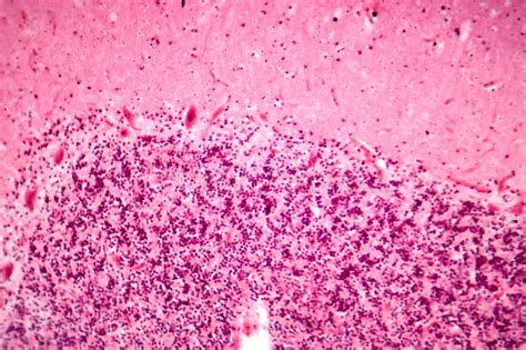 Human Motor Cortex Photomicrograph Showing Pyramidal Neurons In Cortical Layers Responsible For