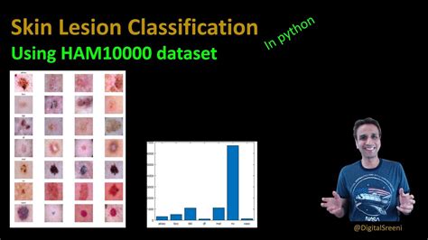 203 Skin Cancer Lesion Classification Using The Ham10000 Dataset