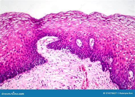 Squamous Epithelial Cells Under Microscope View For Education Hi Stock