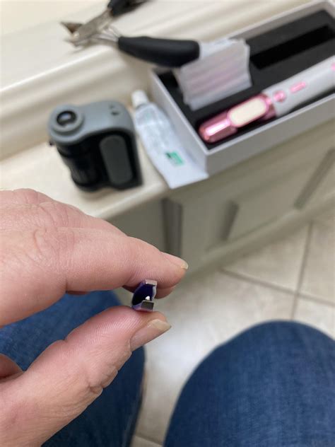 Help First Wart Ever Small Ball Popped Out Is It Over Should I Stop Treating It R Warts