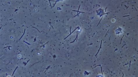 Bacterial Plaque