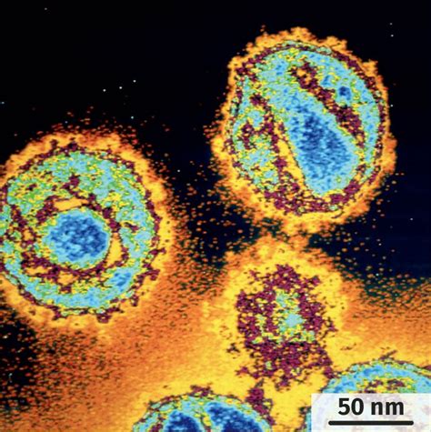 Agents Pathogènes Et Maladies Genially
