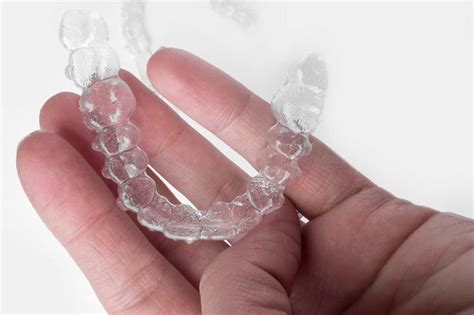 How Does Invisalign Work Aliso Viejo Ca