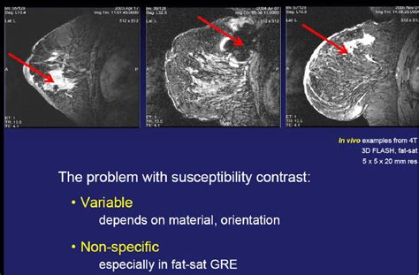 Figure 2 From New Soft Tissue Marker Optimized For Mriultrasound And